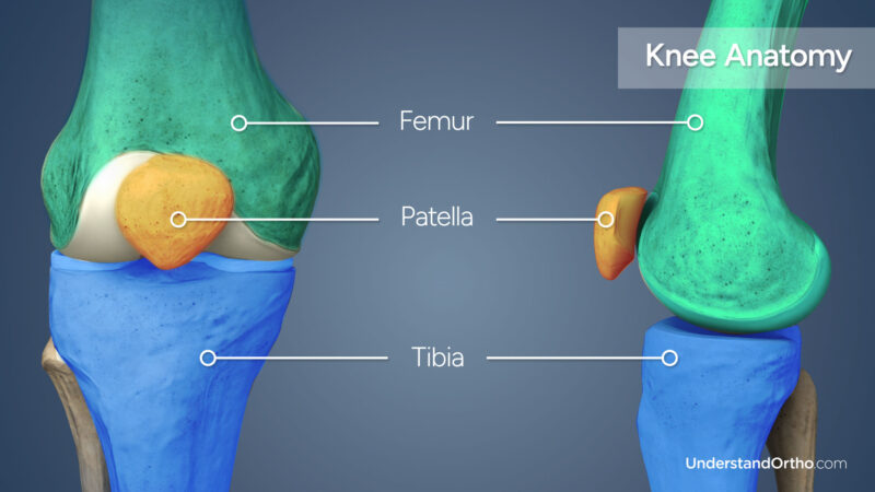 Patellar Realignment (Patellar Tendon Surgery) - Alwin Almeida ...